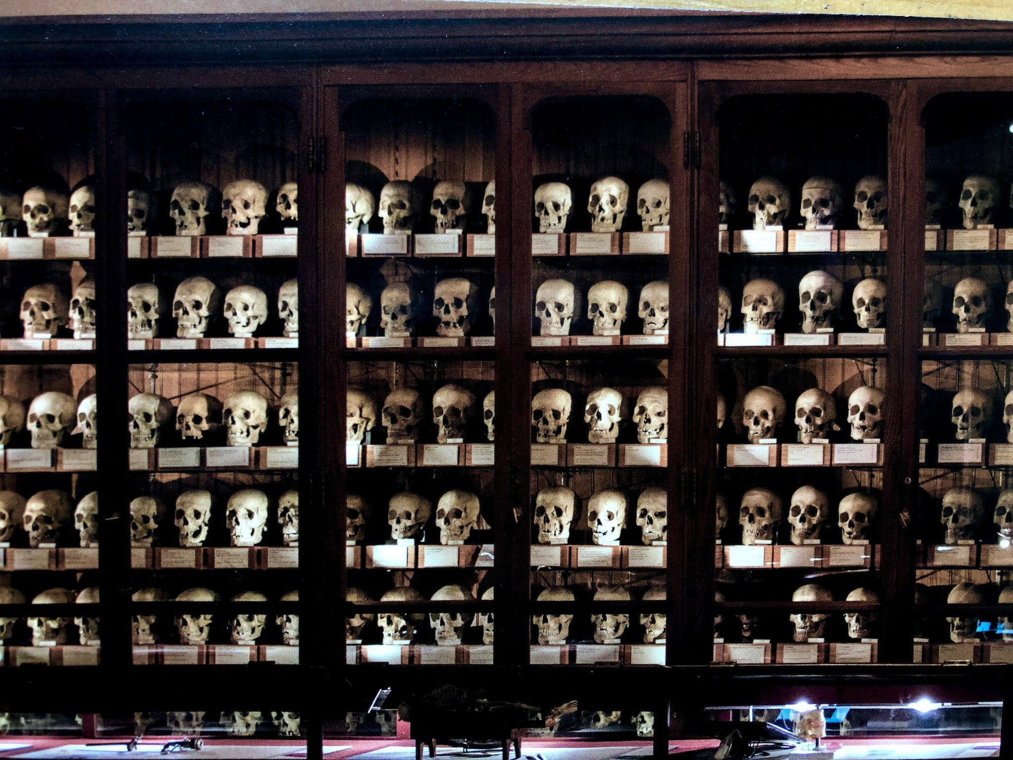 Philly’s Creepiest Museum – The Mutter Museum – Secrets of Philadelphia